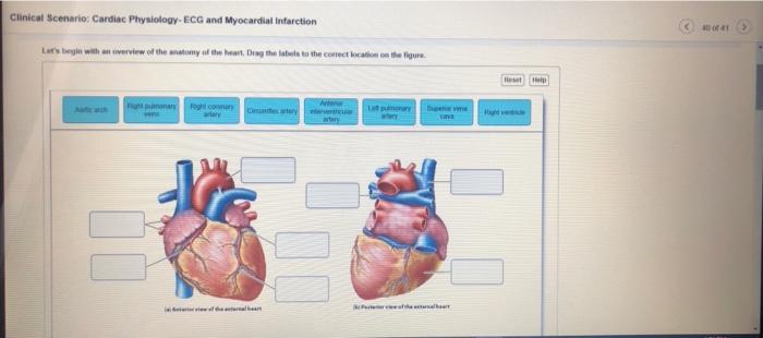 Solved மகா Clinical Scenario: Cardiac Physiology. ECG and | Chegg.com