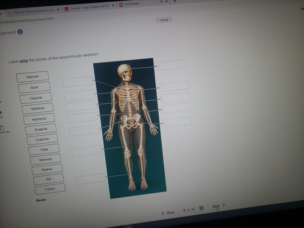 Solved Place the following bones in or | Chegg.com