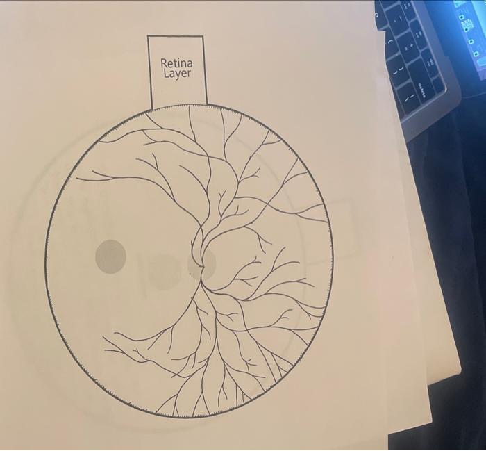 Solved Can You Label The Optic Disc Macula Lutea Fovea