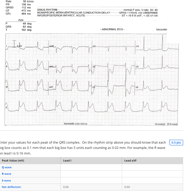 Solved Enter your values for each peak of the QRS complex. | Chegg.com