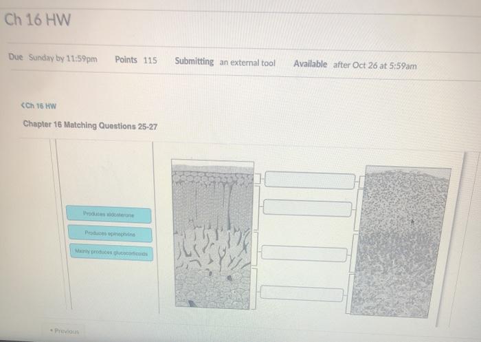 Solved Ch 16 HW Due Sunday by 11:59pm Points 115 Submitting | Chegg.com