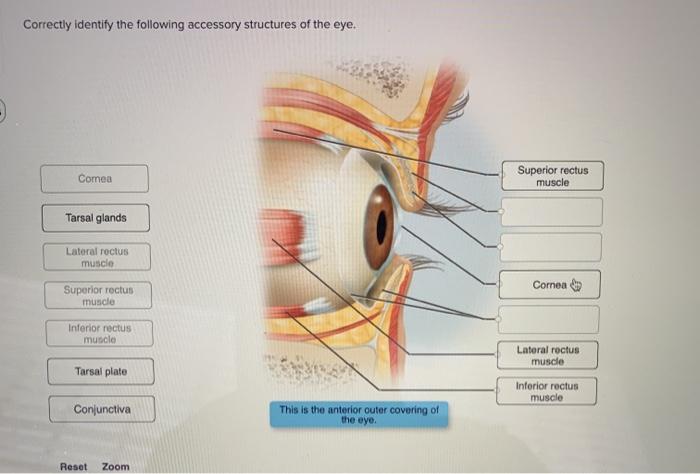 Solved Correctly identify the following accessory structures | Chegg.com
