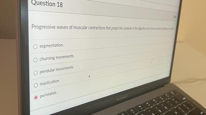 Solved segmentation. churning movements. pendular movements. | Chegg.com