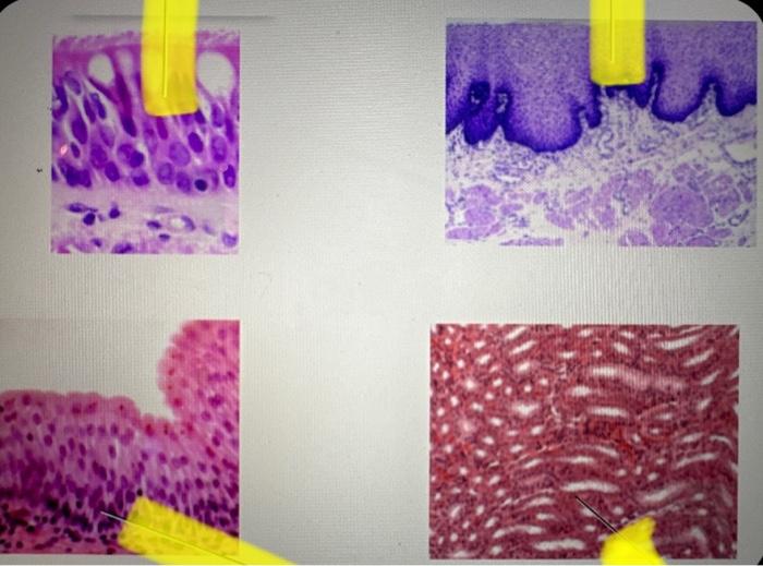 Solved Drag each tissue type to its correct | Chegg.com Solved Drag each tissue type to its correct | Chegg.com