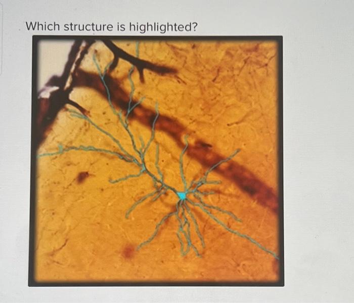Solved Which structure is hiahliahted? Multiple Choice | Chegg.com