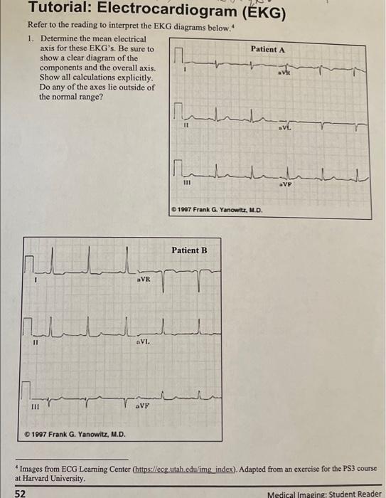 Tutorial: Electrocardiogram (EKG) Refer to the | Chegg.com