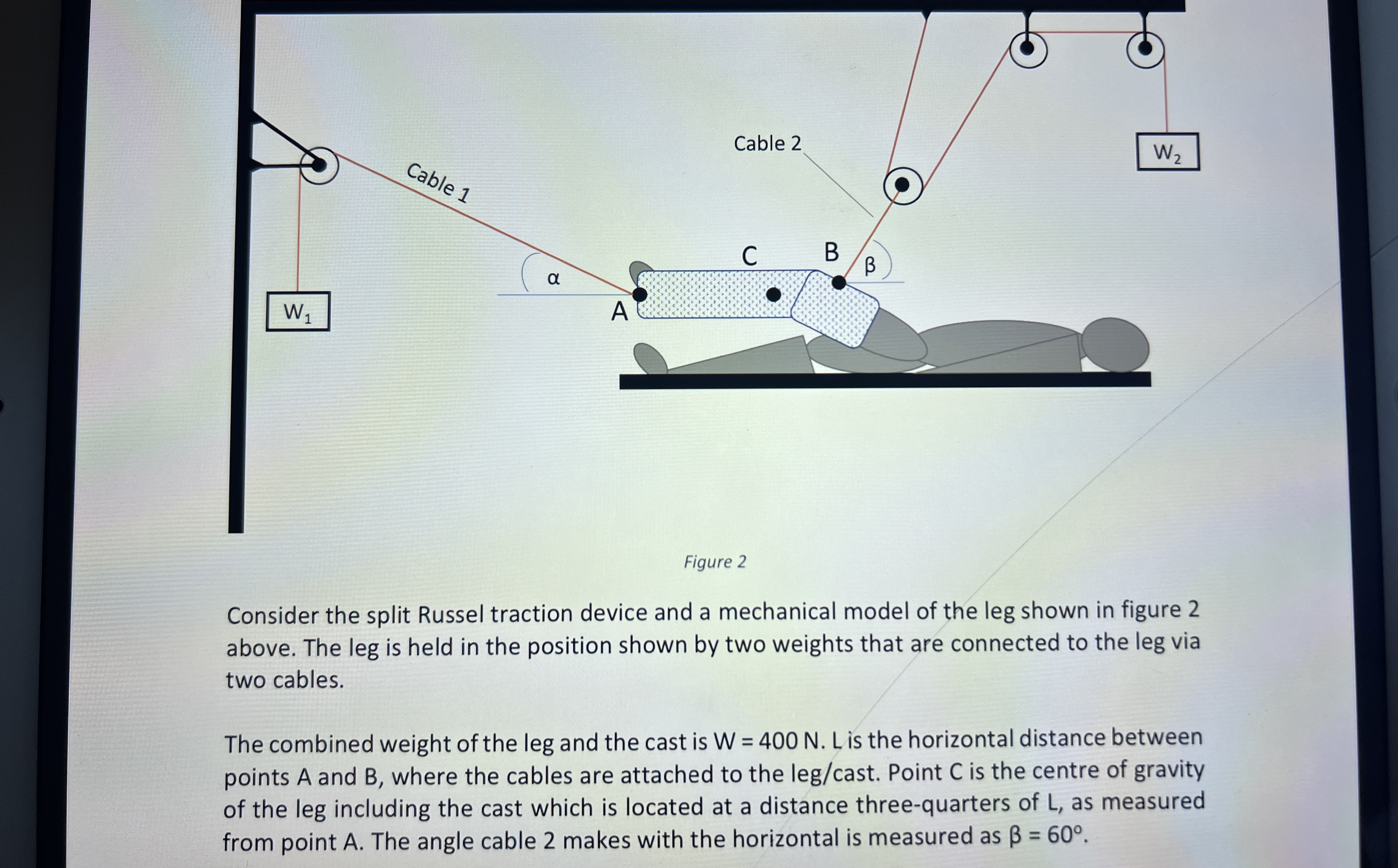 Figure 2Consider the split Russel traction device and | Chegg.com