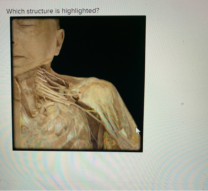 Solved Which structure is highlighted? O median nerve O | Chegg.com
