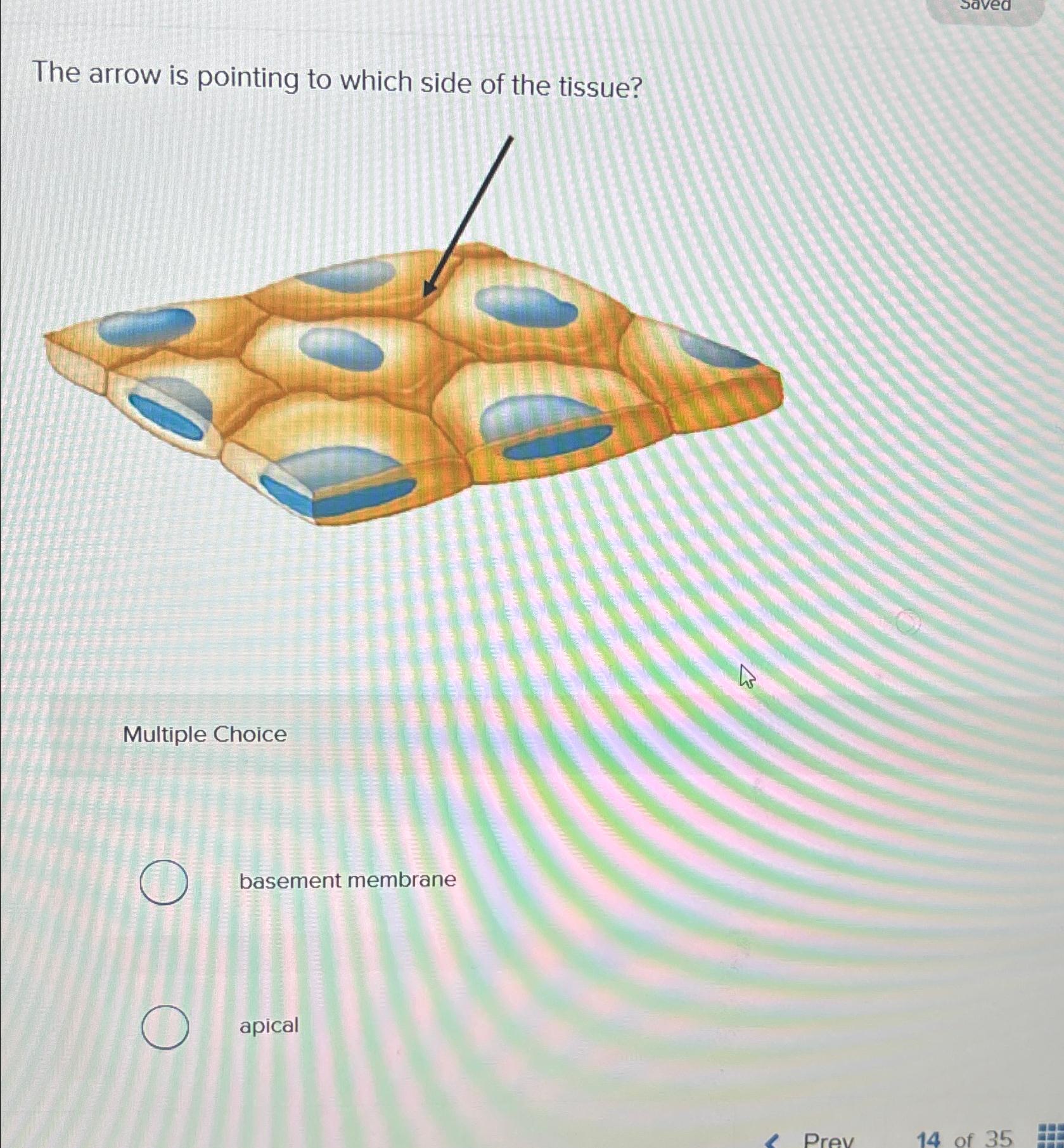 Solved The arrow is pointing to which side of the | Chegg.com