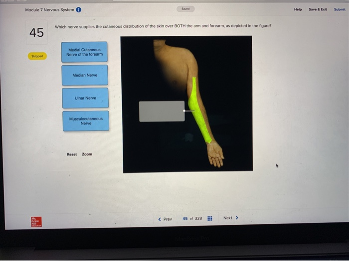 Solved Module 7 Nervous System Saved Help Save & Exit Submit | Chegg.com