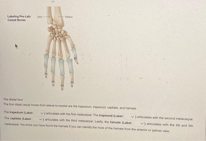 It is best to organize the eight carpal bones into | Chegg.com