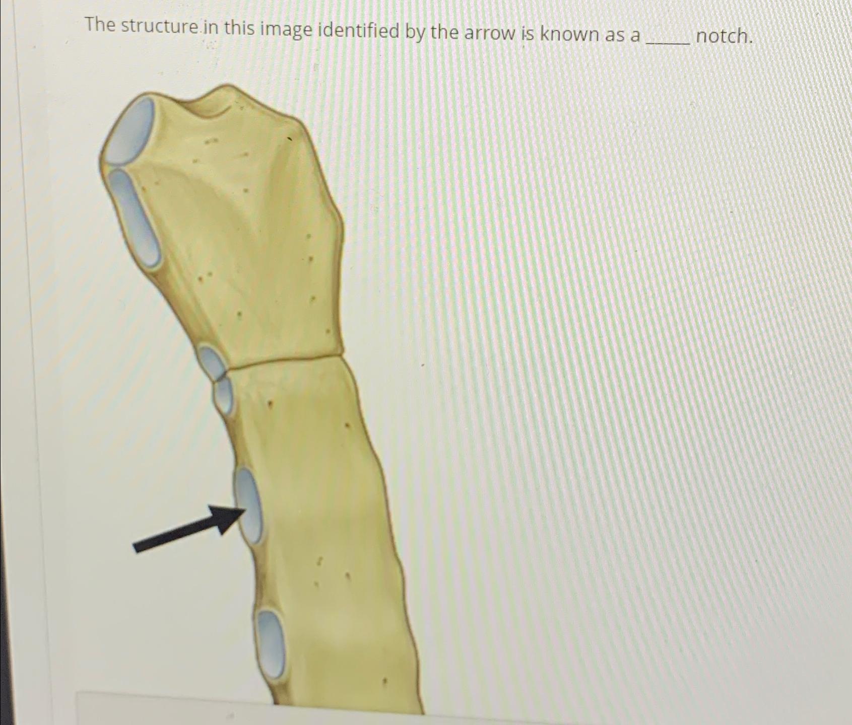 Solved The structure in this image identified by the arrow | Chegg.com