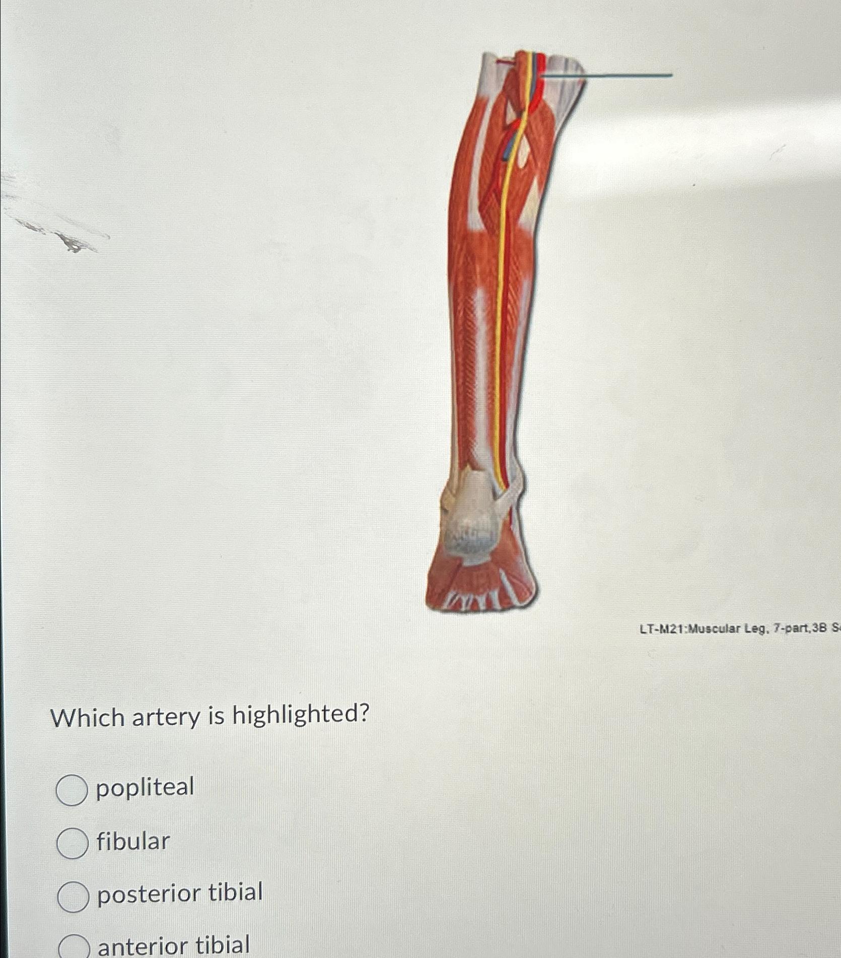 Solved LT-M121:Muscular Leg. 7-part, 3BWhich artery is | Chegg.com