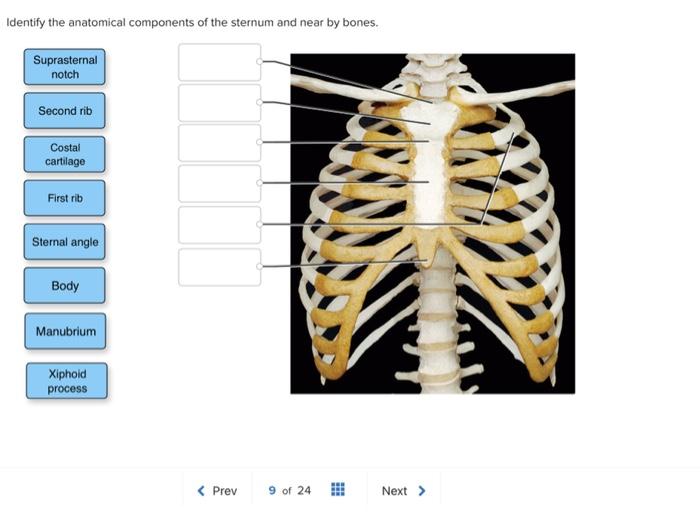 Solved Identify the features of the typical rib that | Chegg.com