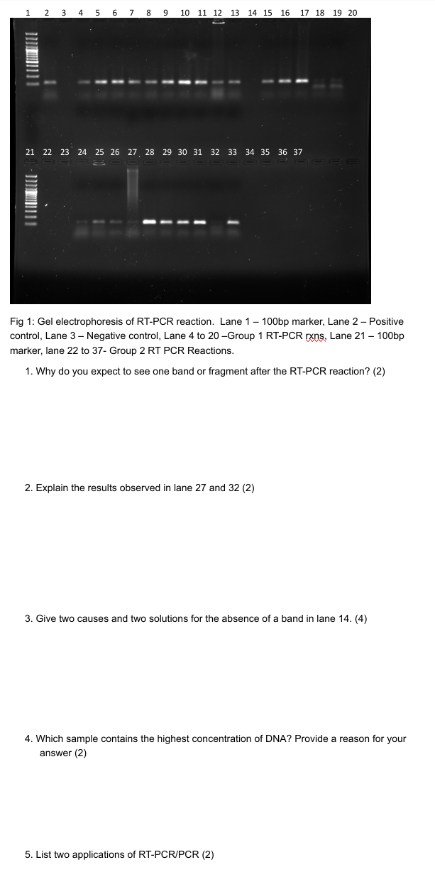 Solved Fig 1: Gel electrophoresis of RT-PCR reaction. Lane 1 | Chegg.com