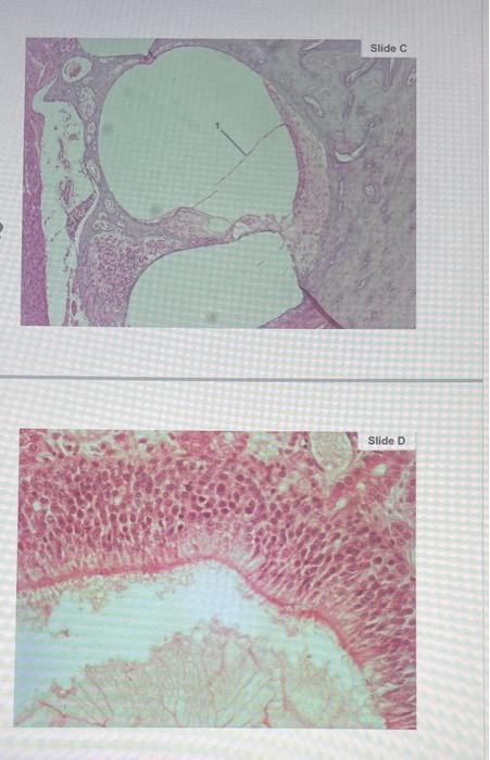 Solved Slide C: This slide shows a cross section of the? | Chegg.com