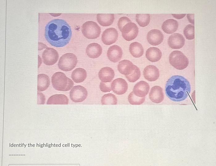 Solved Identify the highlighted cell type. | Chegg.com Solved Identify the highlighted cell type. | Chegg.com