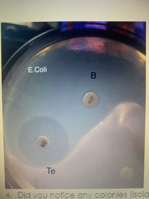 Solved did you notice any colonies growing within any of the | Chegg.com