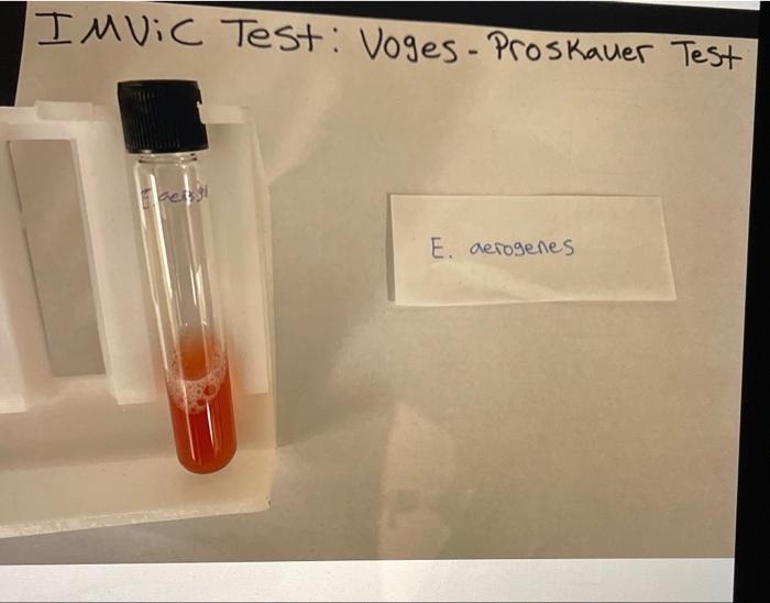 Solved PART B: Methyl Red Test and Voges-Proskauer Test | Chegg.com