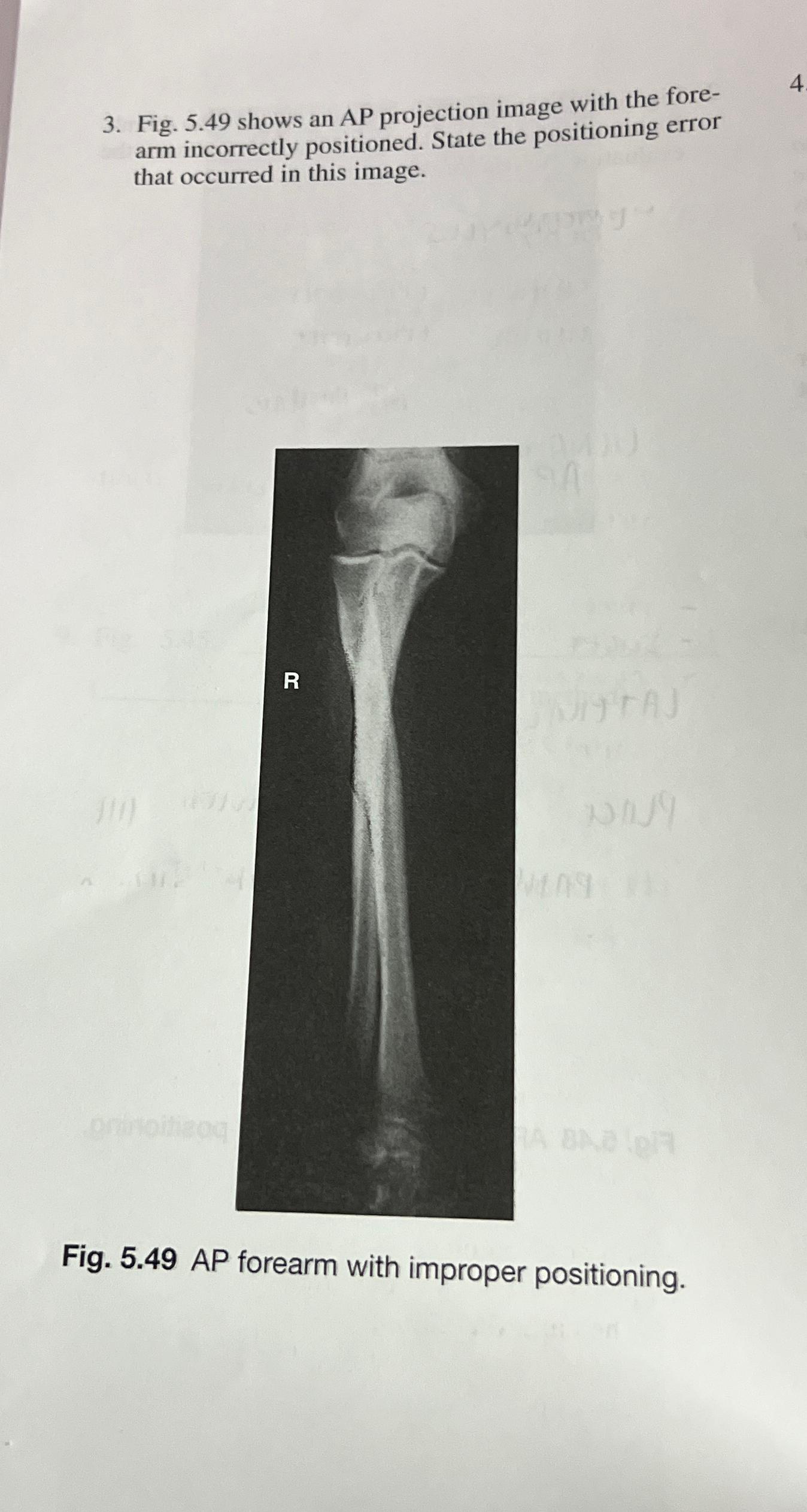 Solved Fig. 5.49 ﻿shows an AP projection image with the | Chegg.com