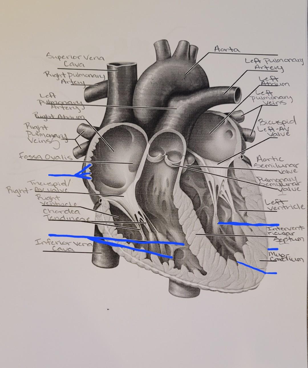 Solved Aorta Superior Vena Cava Right pulmonary Left | Chegg.com