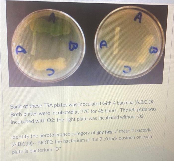 Solved A B D B. Each of these TSA plates was inoculated with | Chegg.com