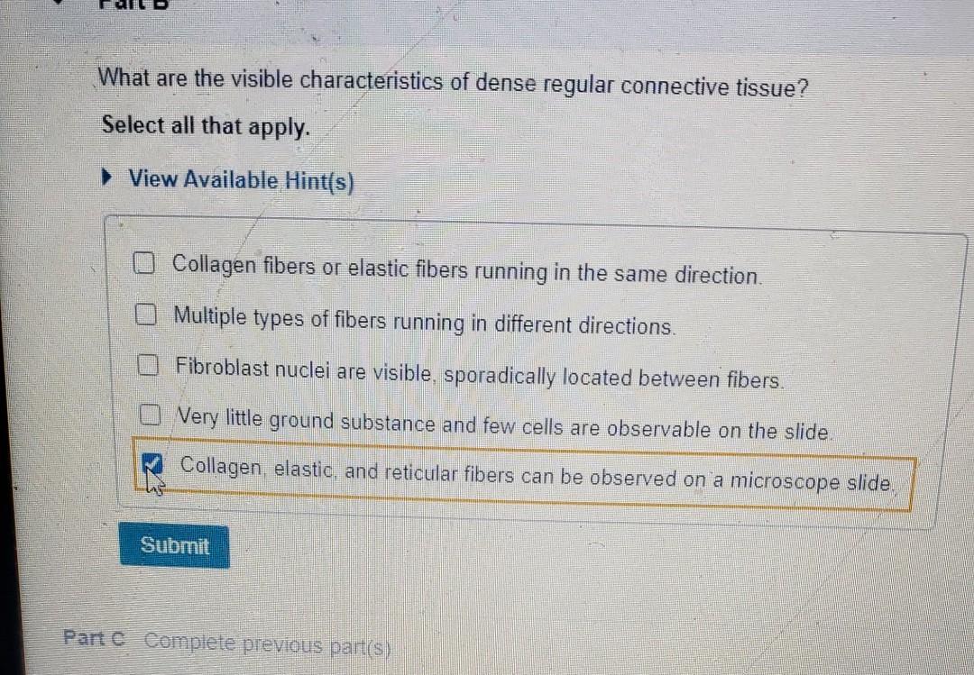 Solved What are the visible characteristics of dense regular | Chegg.com