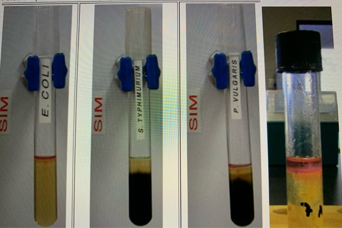 Solved SIM E. COLI SIM S. TYPHIMURIUM SIM P. VULGARIS | Chegg.com