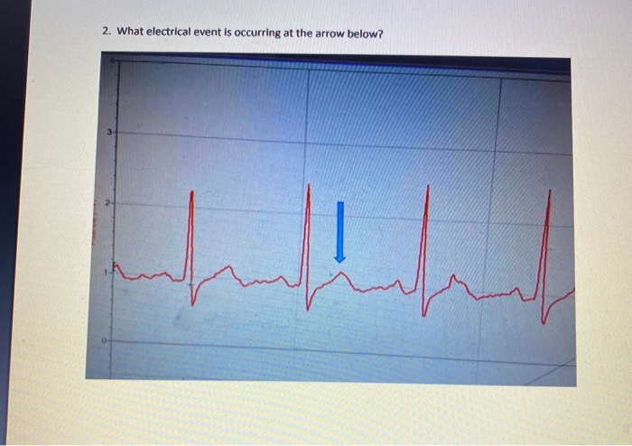 Solved 2. What electrical event is occurring at the arrow | Chegg.com