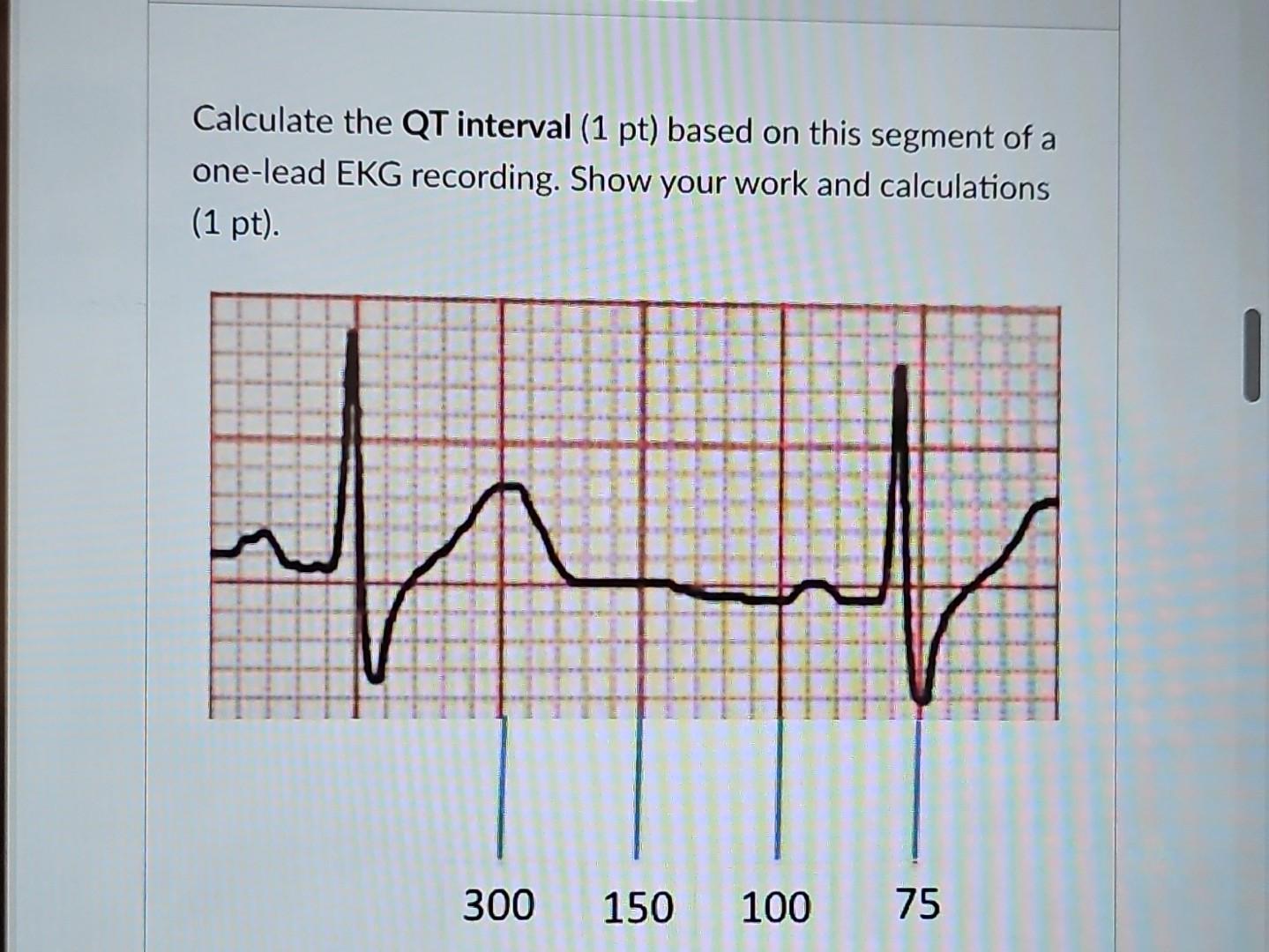 Calculate the QT interval (1 pt) based on this | Chegg.com