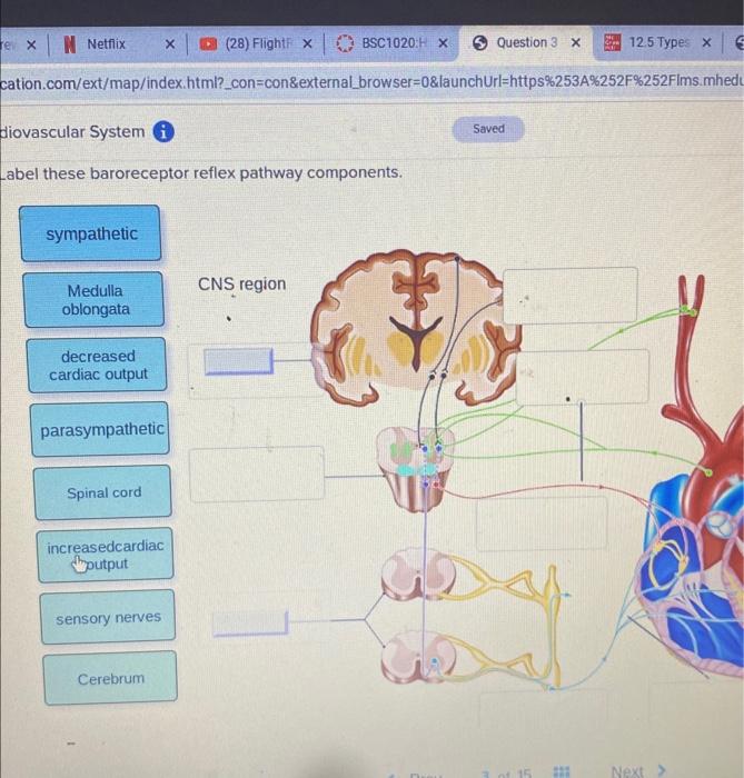 abel these baroreceptor reflex pathway components. | Chegg.com