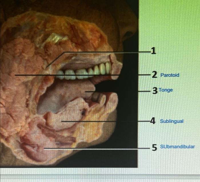 Submandibular Gland Cadaver