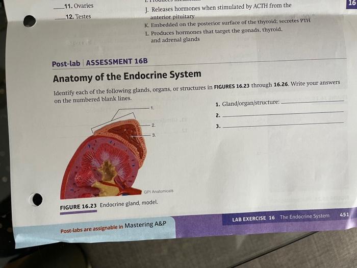 Solved 11. Ovaries 12. Testes J. Releases hormones when | Chegg.com