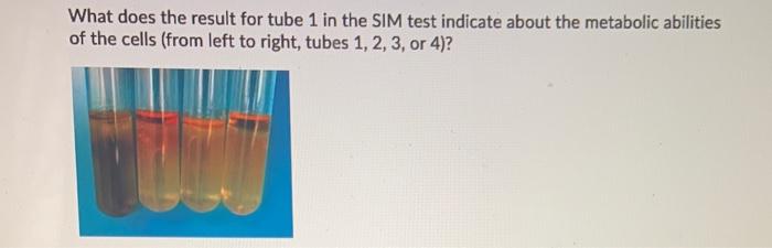Solved What does the result for tube 1 in the SIM test | Chegg.com