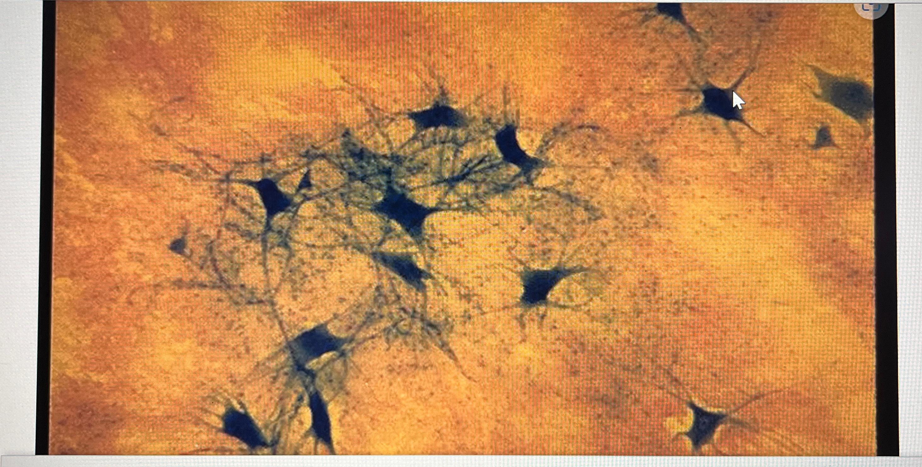 Solved Which Type Of Tissue Is Depicted In The Picture Chegg