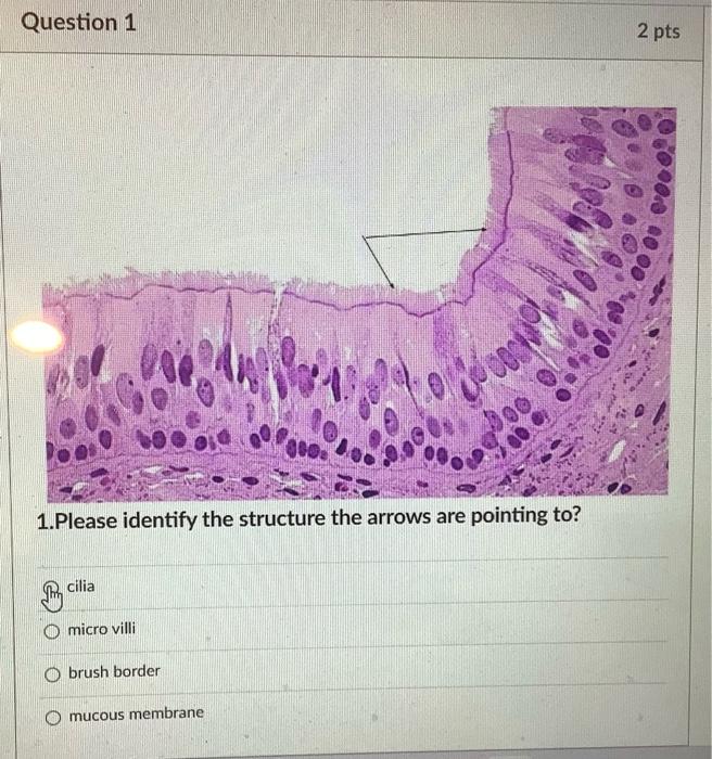 [Solved]: 1.Please identify the structure the arrows are po