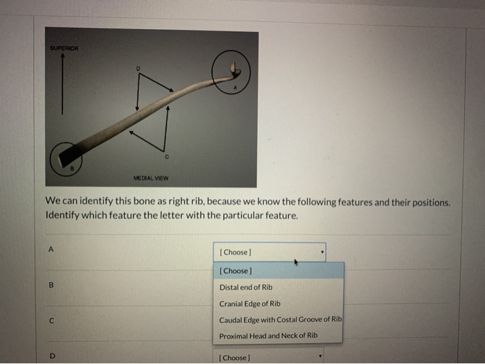Solved SUPERIOR MEDIAL VIEW We can identify this bone as | Chegg.com