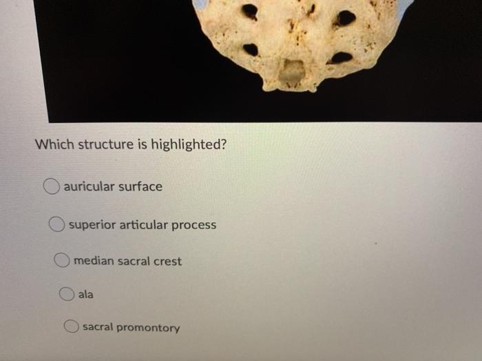 Solved Which structure of the scapula is highlighted? spine | Chegg.com