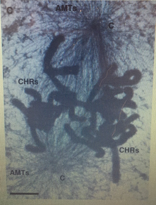 Solved What happens during Early Prometaphase (1st picture) | Chegg.com