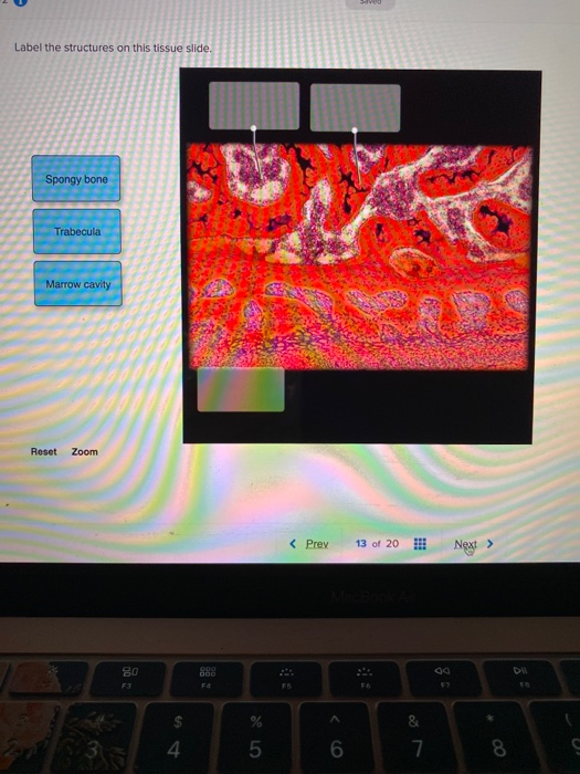 Solved 20 Saved Label the structures on this tissue slide. | Chegg.com