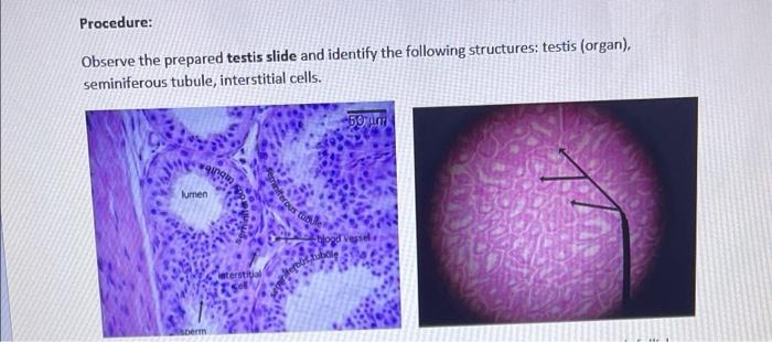 Testis Slide Seminiferous Tubules