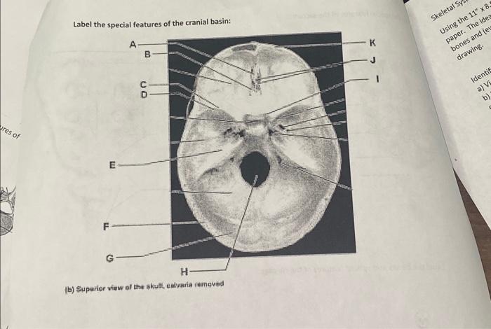 Label the soecial features of the cranial basin: | Chegg.com