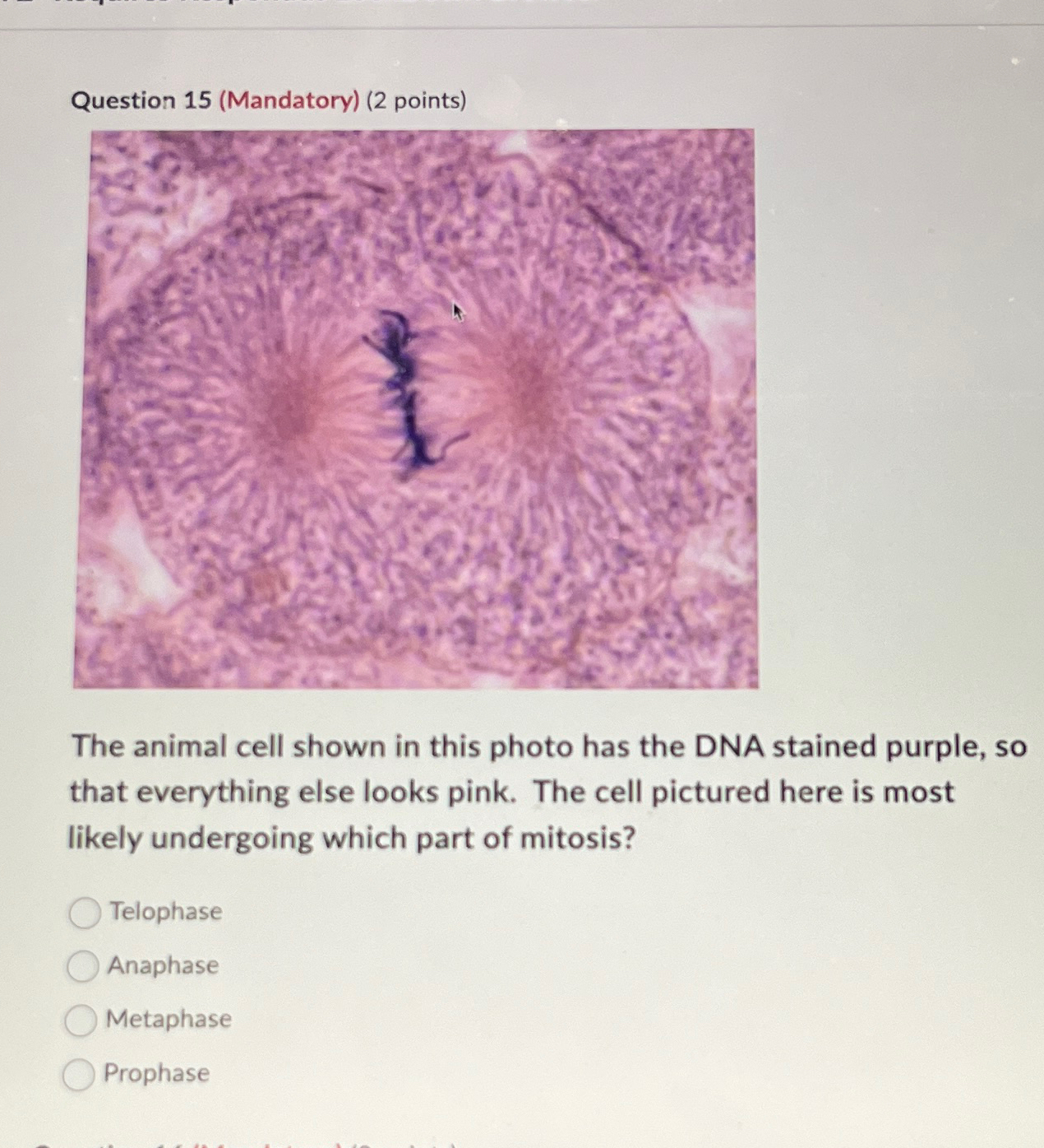 Solved Question 15 (Mandatory) (2 points)The animal cell | Chegg.com Solved Question 15 (Mandatory) (2 points)The animal cell | Chegg.com