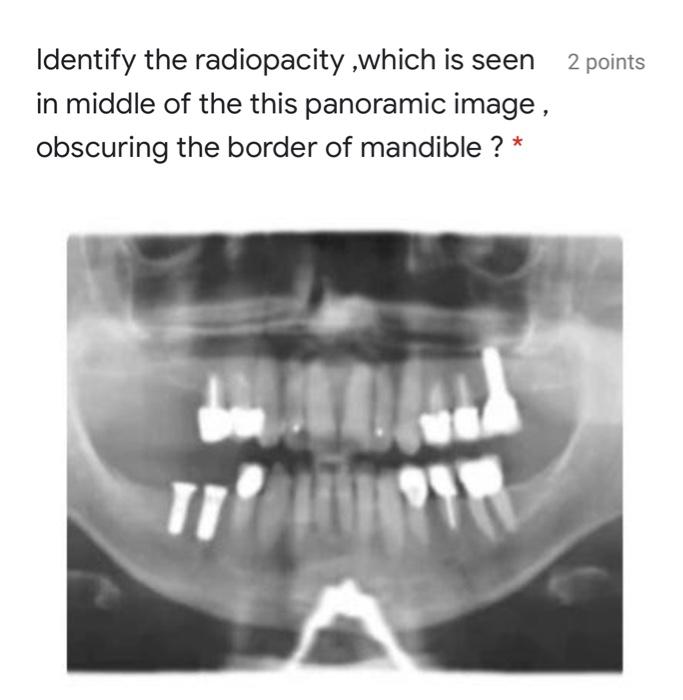 Solved 2 points Identify the radiopacity ,which is seen in | Chegg.com