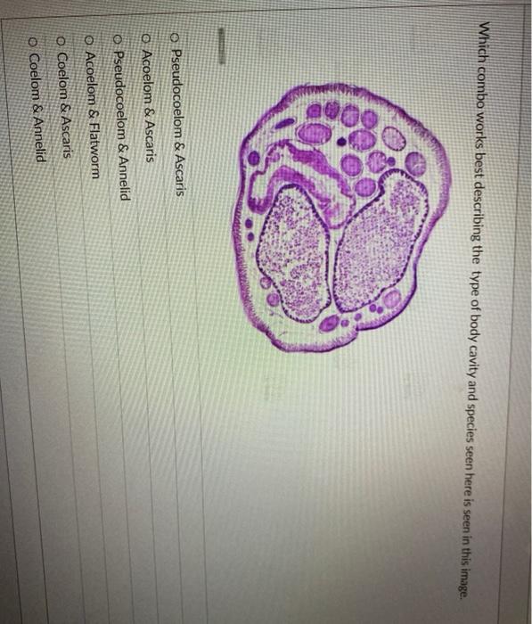 Solved Which combo works best describing the type of body | Chegg.com