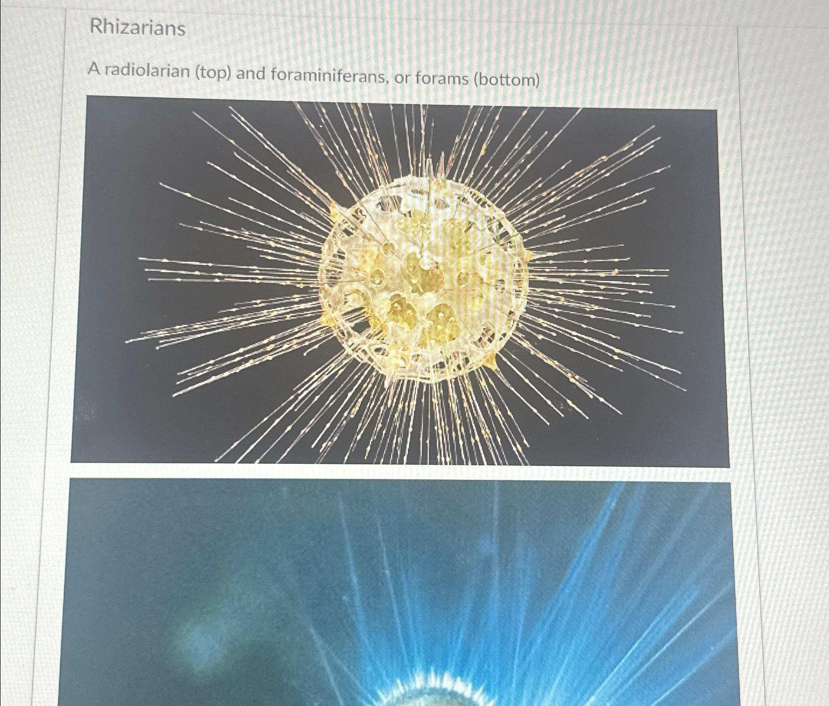 Solved RhizariansA radiolarian (top) ﻿and foraminiferans, or | Chegg.com