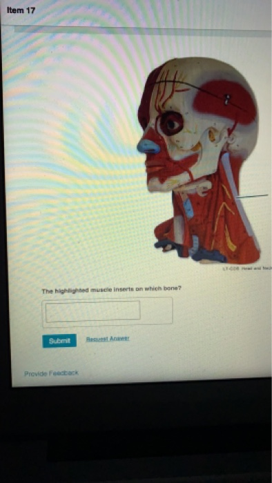 Solved Item 17 The highlighted muscle inserts on which bone? | Chegg.com