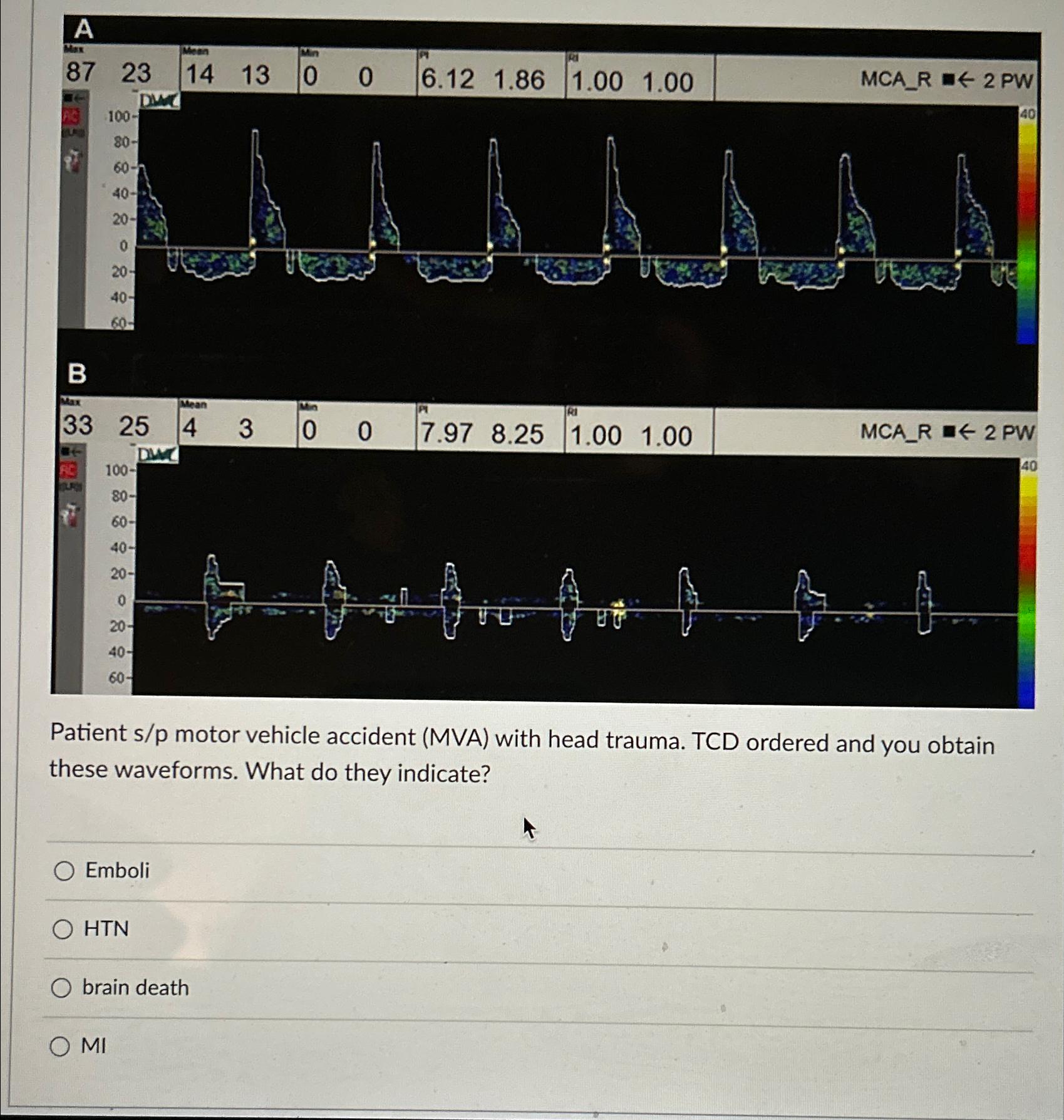 Solved Patient sp ﻿motor vehicle accident (MVA) ﻿with head | Chegg.com