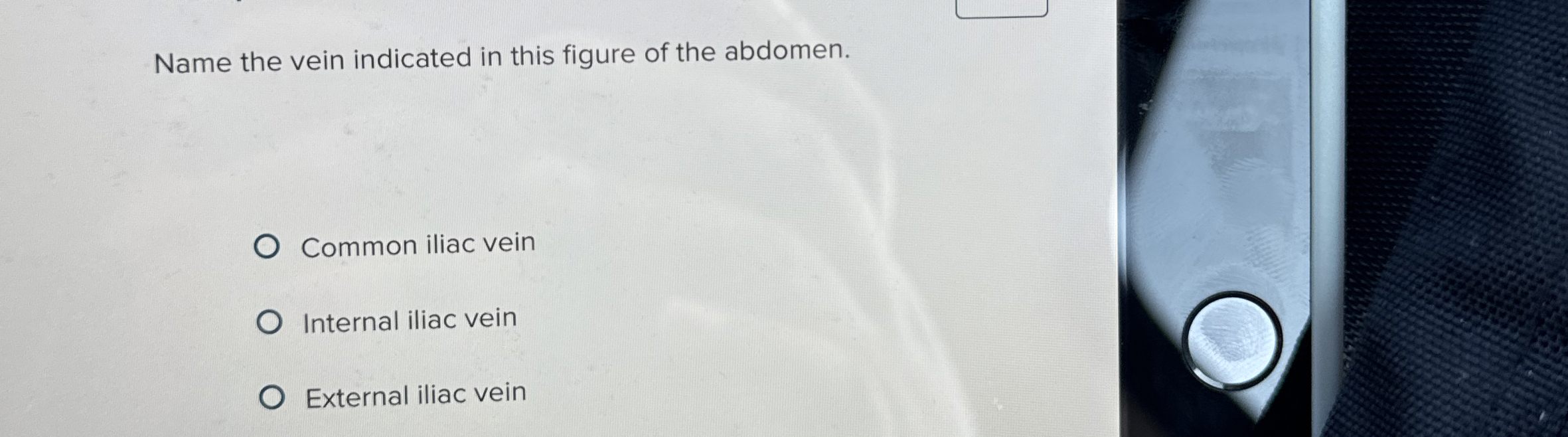 Solved Name the vein indicated in this figure of the | Chegg.com