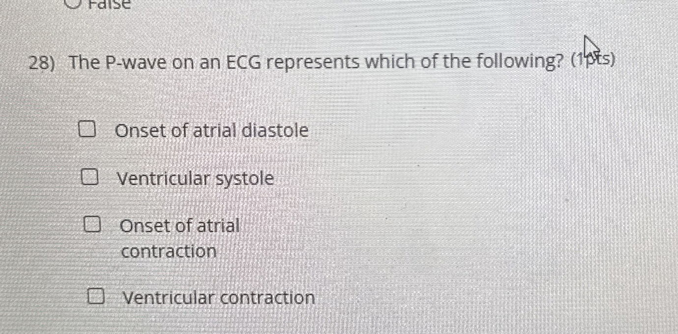 Solved The P-wave on an ECG represents which of the | Chegg.com